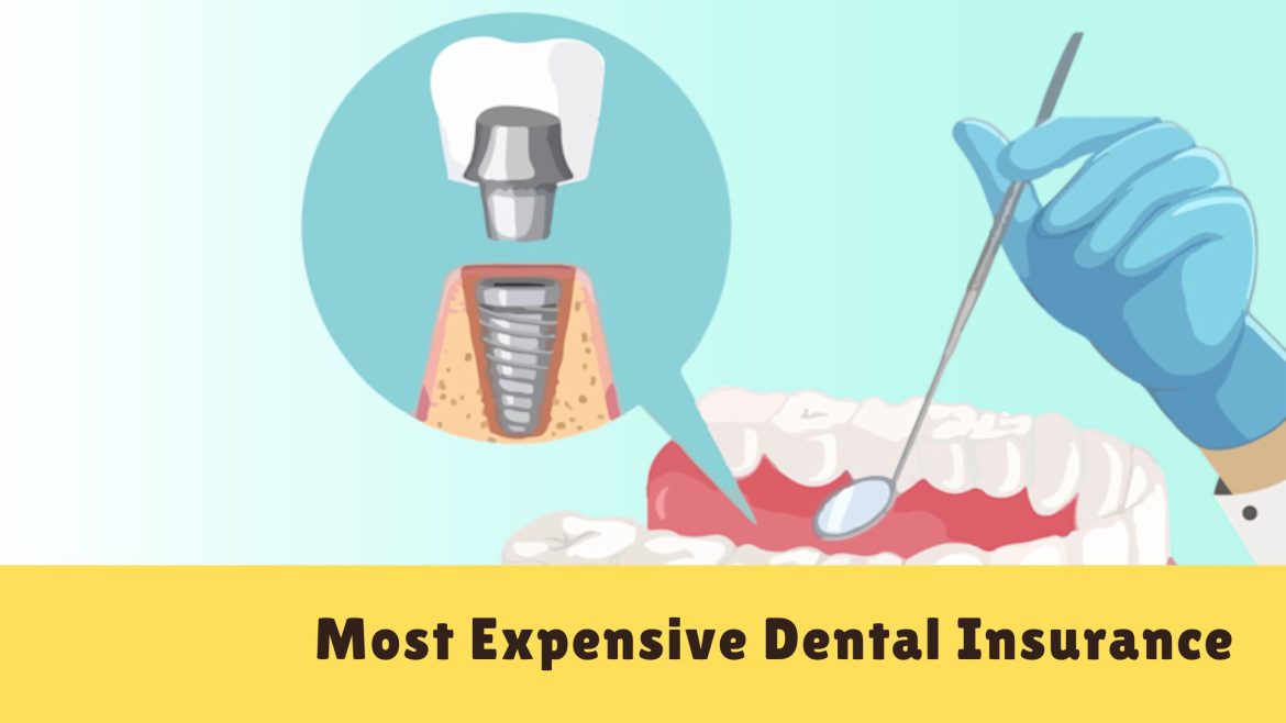 The Most Expensive Dental Insurance Plans